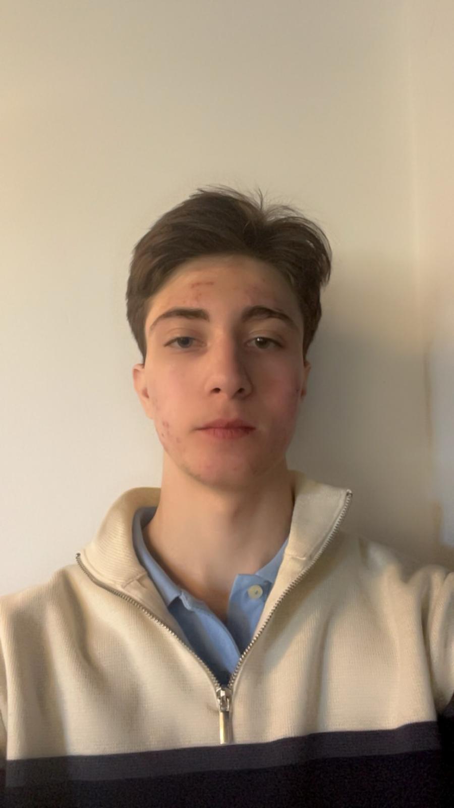 LumoGluco | Temassız Şeker Ölçüm Cihazı